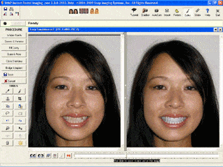 Witness Your New Stunning Smile With Cosmetic Imaging - Rudnick Dentistry